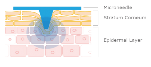 Microneedle Eye Patches – BEAUTICAL