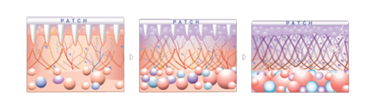 Best Microneedle Eye Patches for Wrinkle Reduction